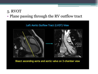 Cardiac Magnetic Resonance Imaging | PPTX