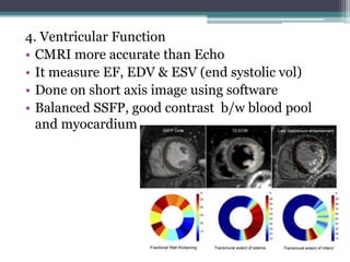 Cardiac Magnetic Resonance Imaging | PPTX
