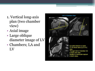 Cardiac Magnetic Resonance Imaging | PPTX