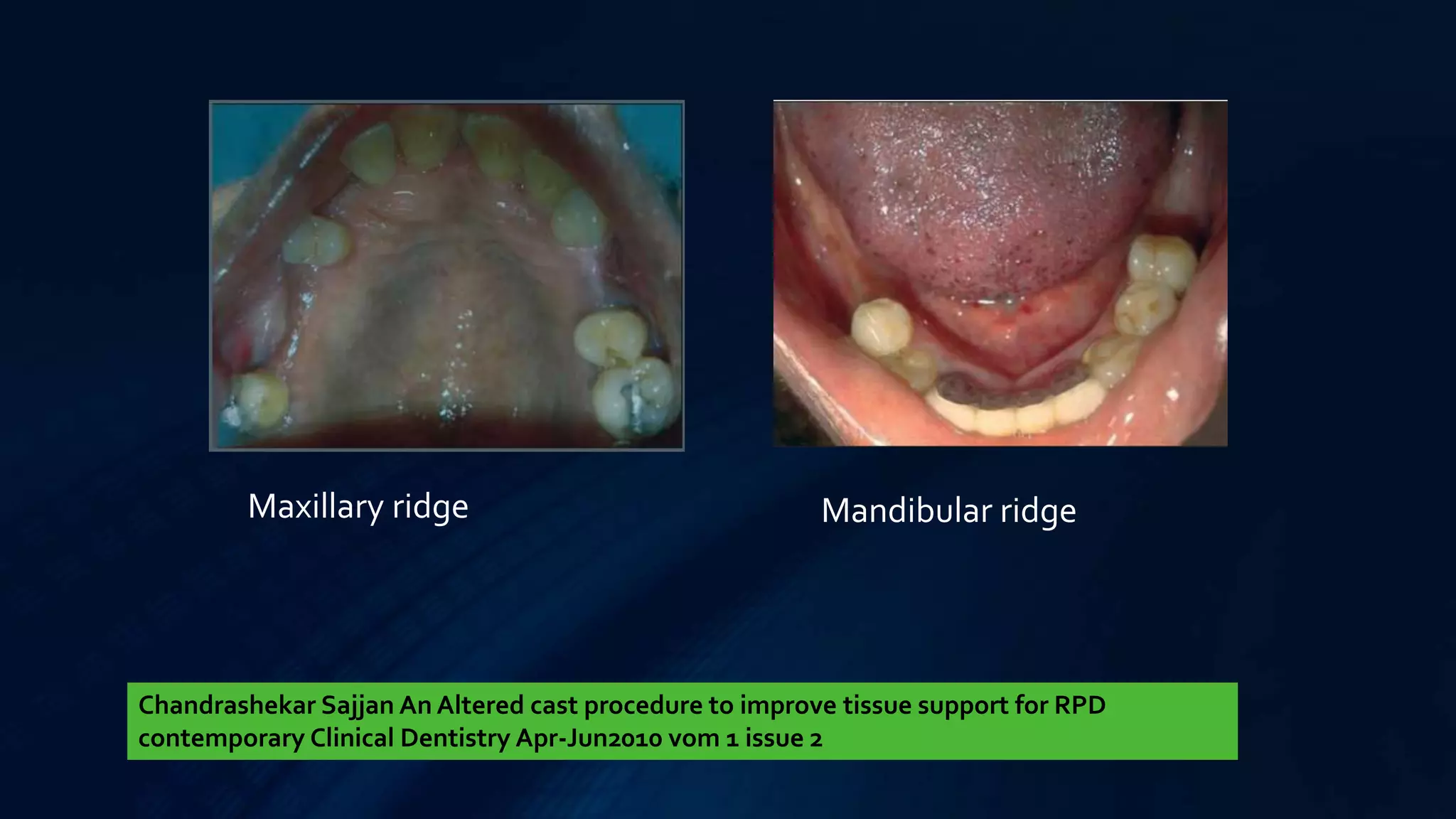 impression in RPD | PPTX