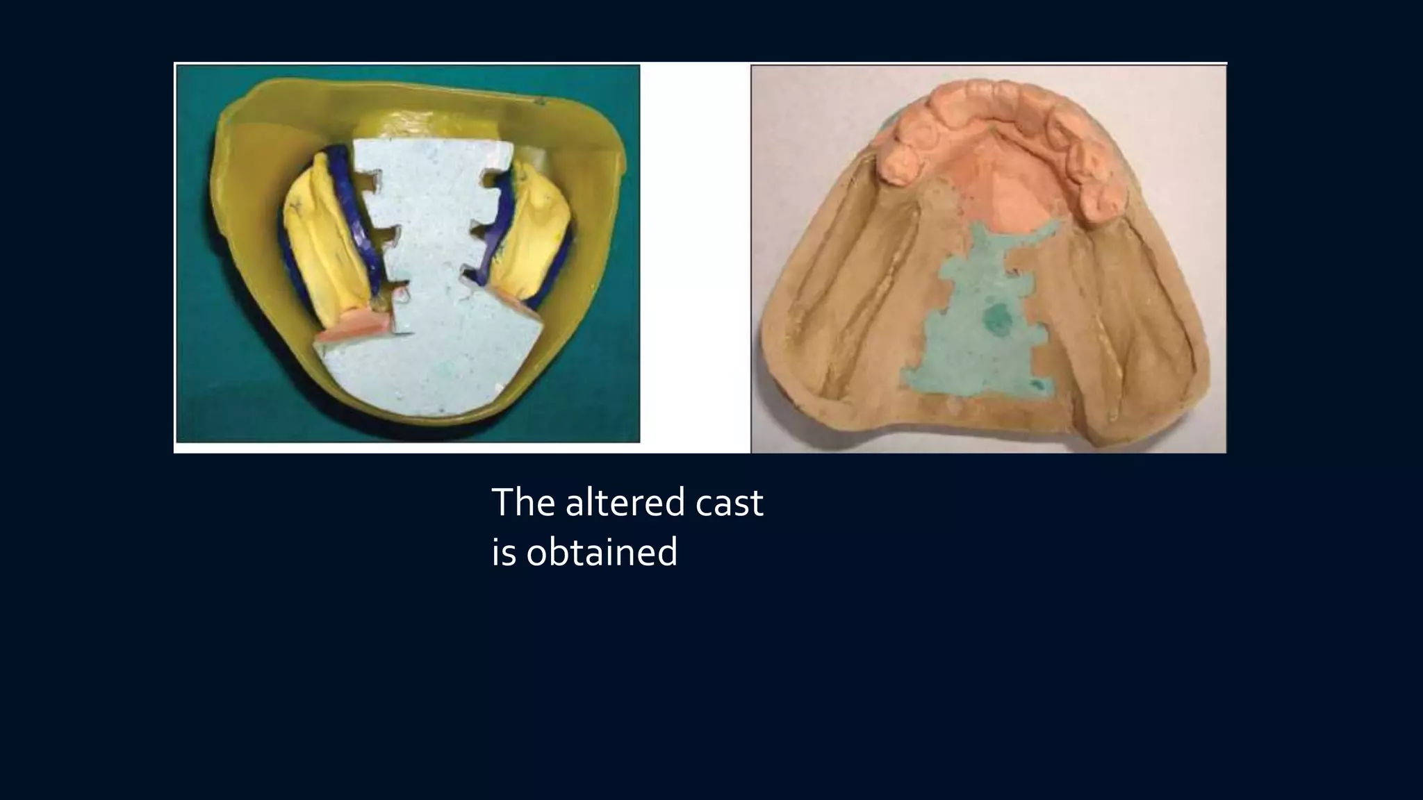 impression in RPD | PPTX