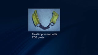 impression in RPD | PPTX