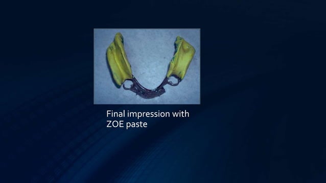 impression in RPD | PPTX | Dental Health | Diseases and Conditions