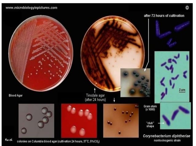 7. coryne bacterium | PPT