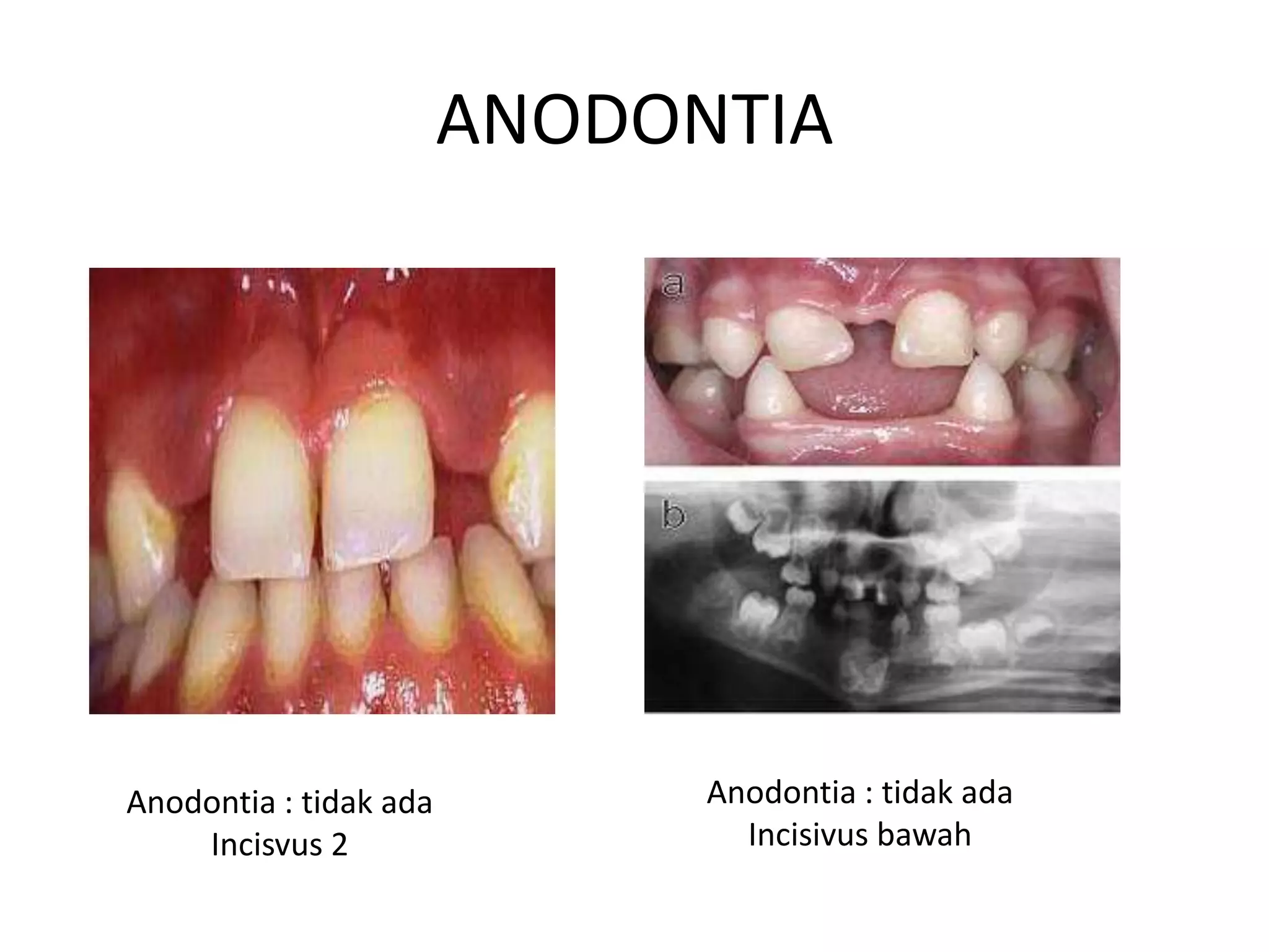 7. anomali gigi | PPTX