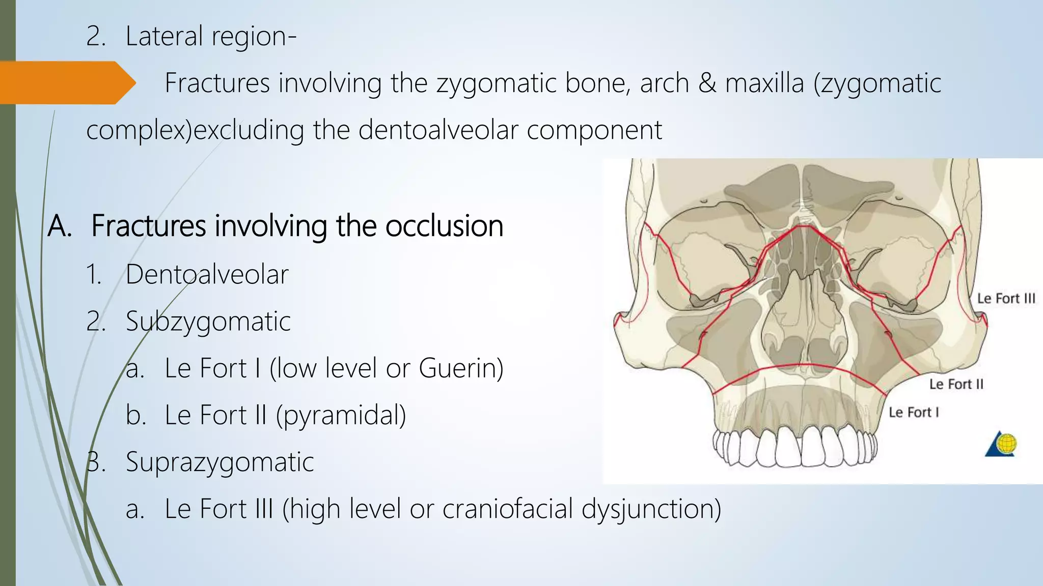 7. fractures of middle third of facial skeleton | PPTX