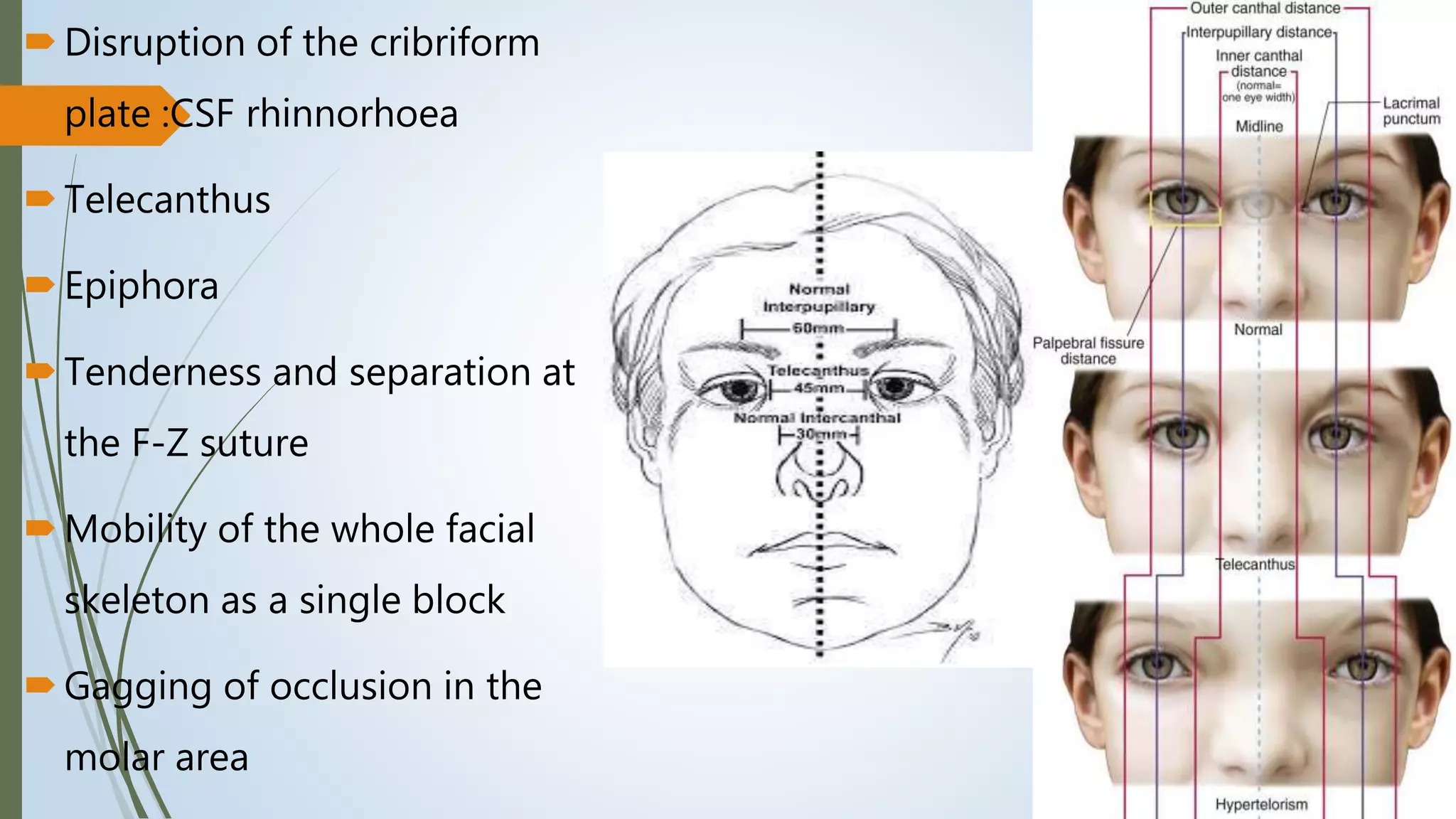 7. fractures of middle third of facial skeleton | PPTX | Death, Injury ...