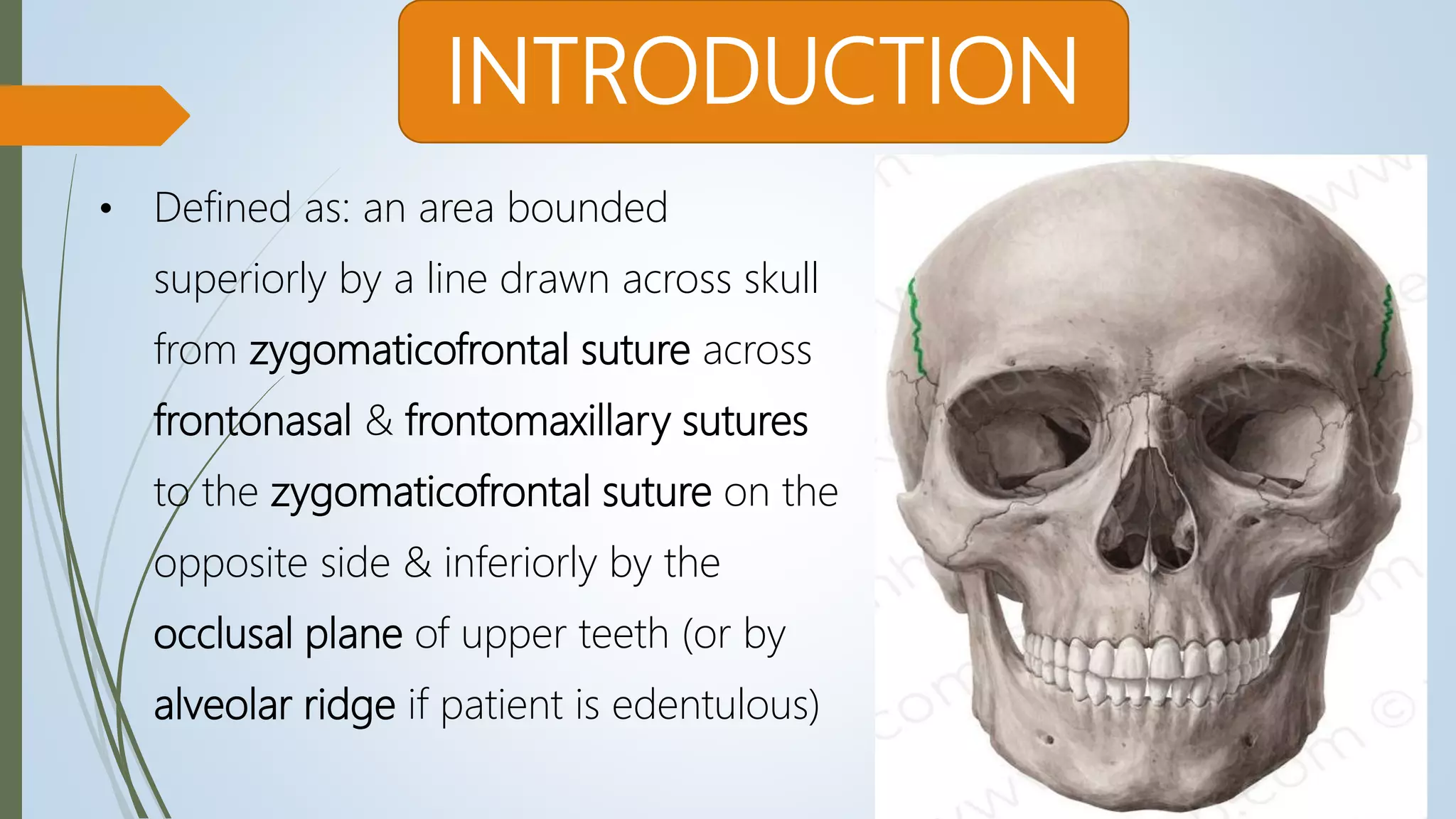 7. fractures of middle third of facial skeleton | PPTX