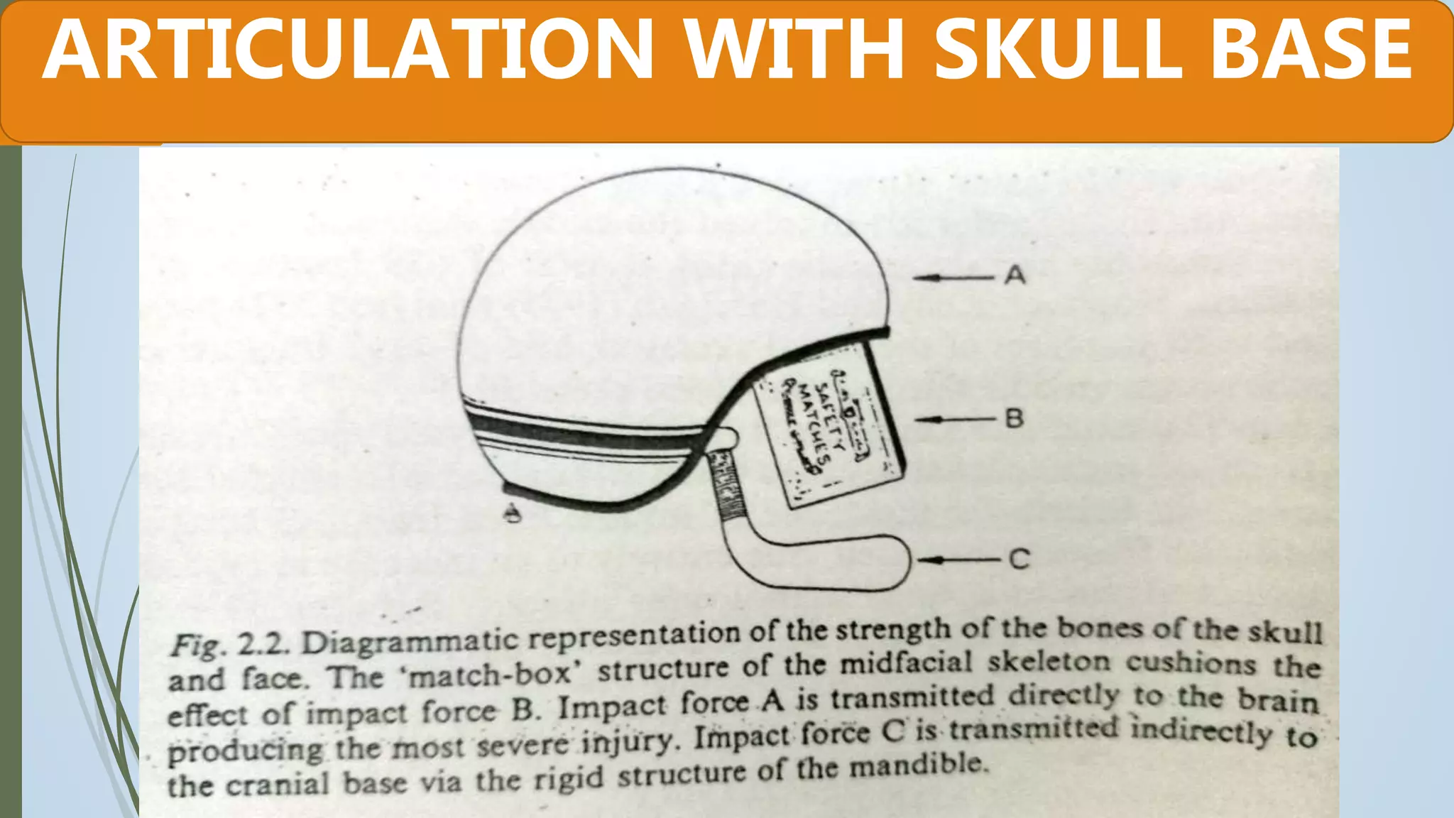 7. fractures of middle third of facial skeleton | PPTX