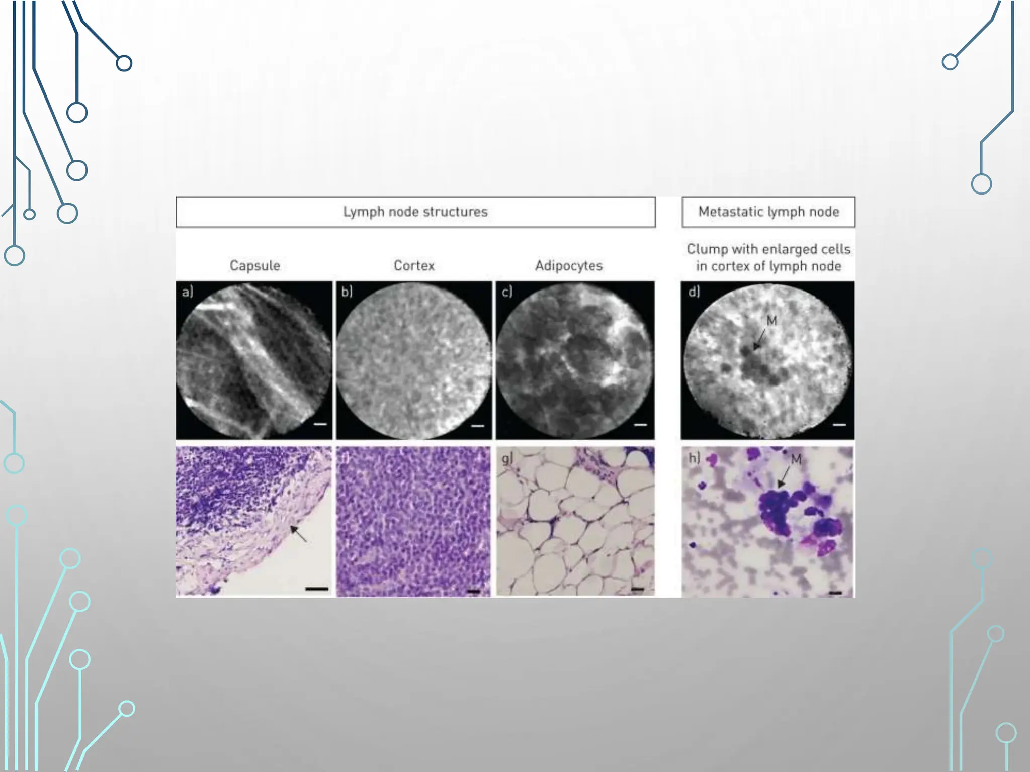 7-1 ARTIFICIAL INTELLIGENCE IN PATHOLOGY semiar 2.pptx