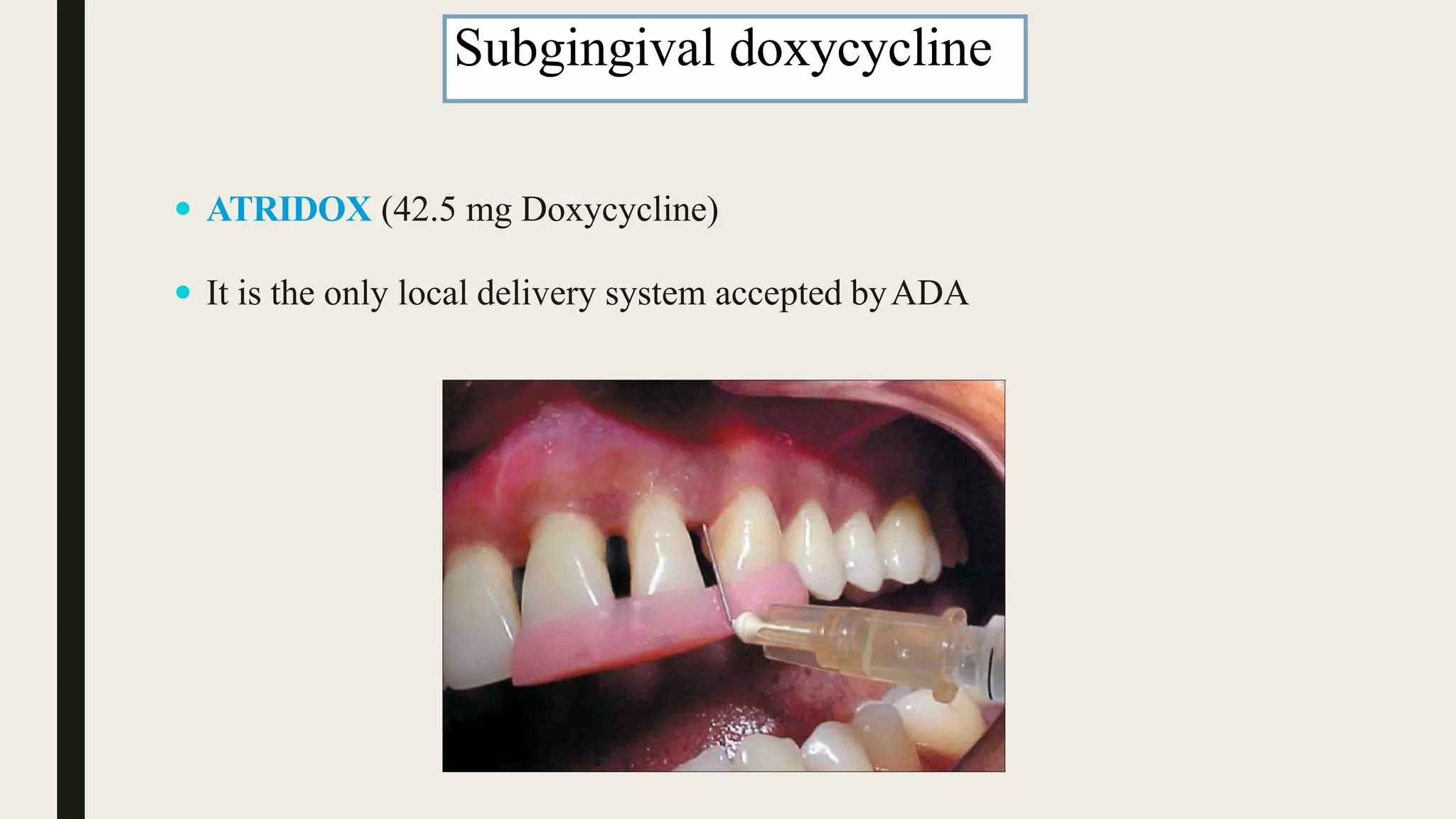 LOCAL DRUG DELIVERY | PPTX