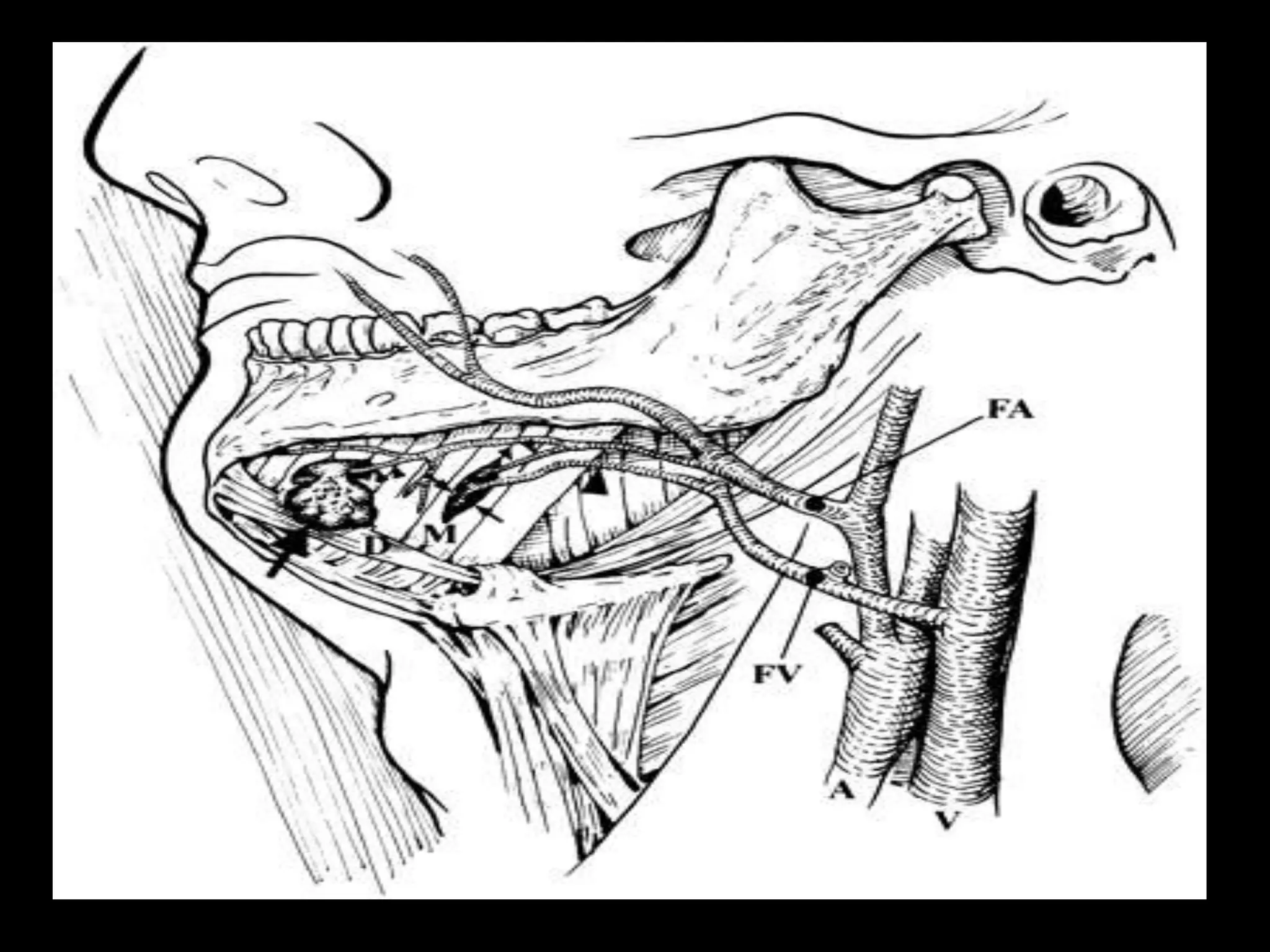Anatomy of neck, deep neck spaces | PPT