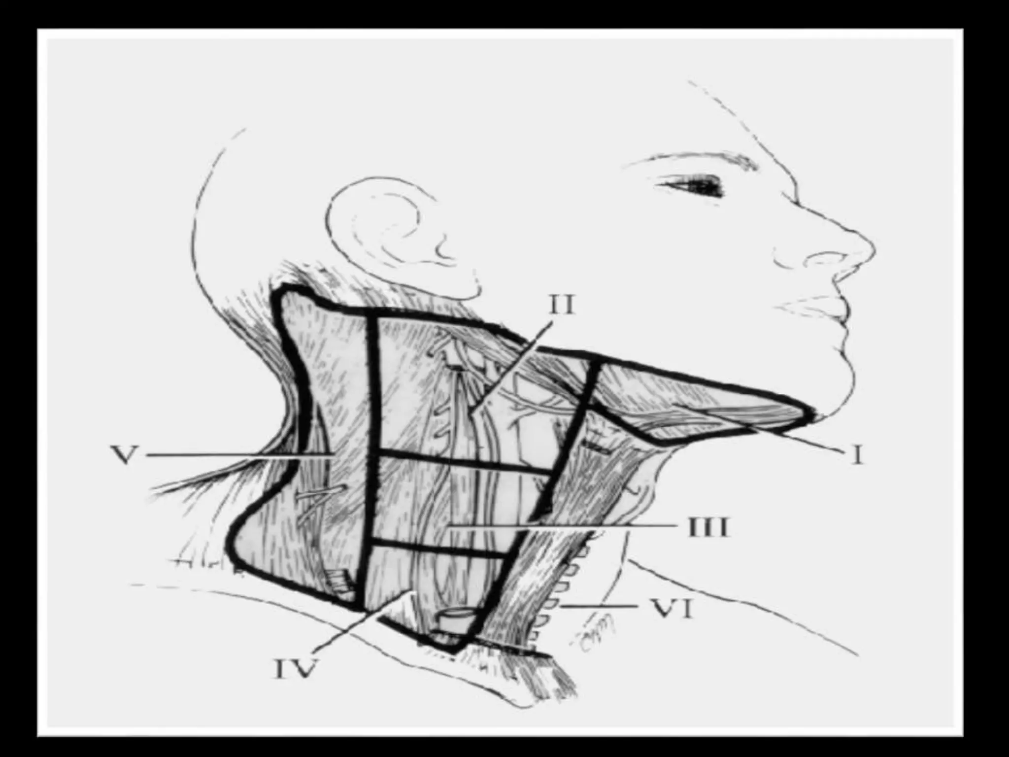 Anatomy of neck, deep neck spaces | PPT