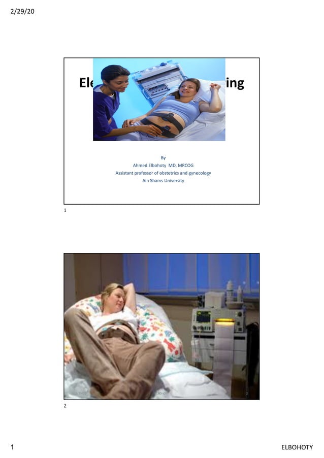 Electronic fetal monitoring | PDF