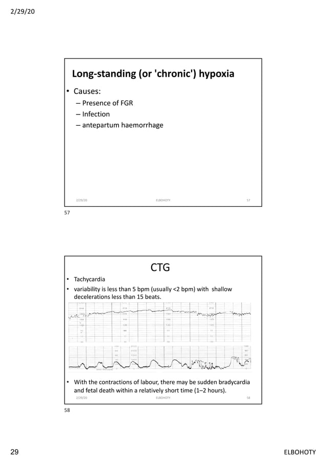 Electronic fetal monitoring | PDF