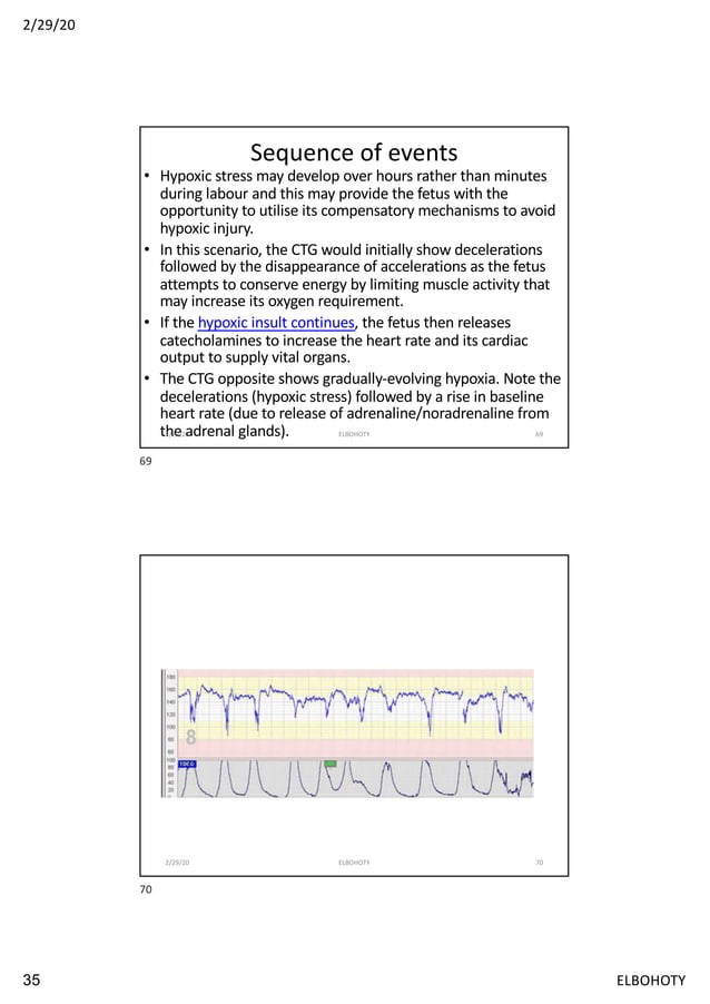 Electronic fetal monitoring | PDF