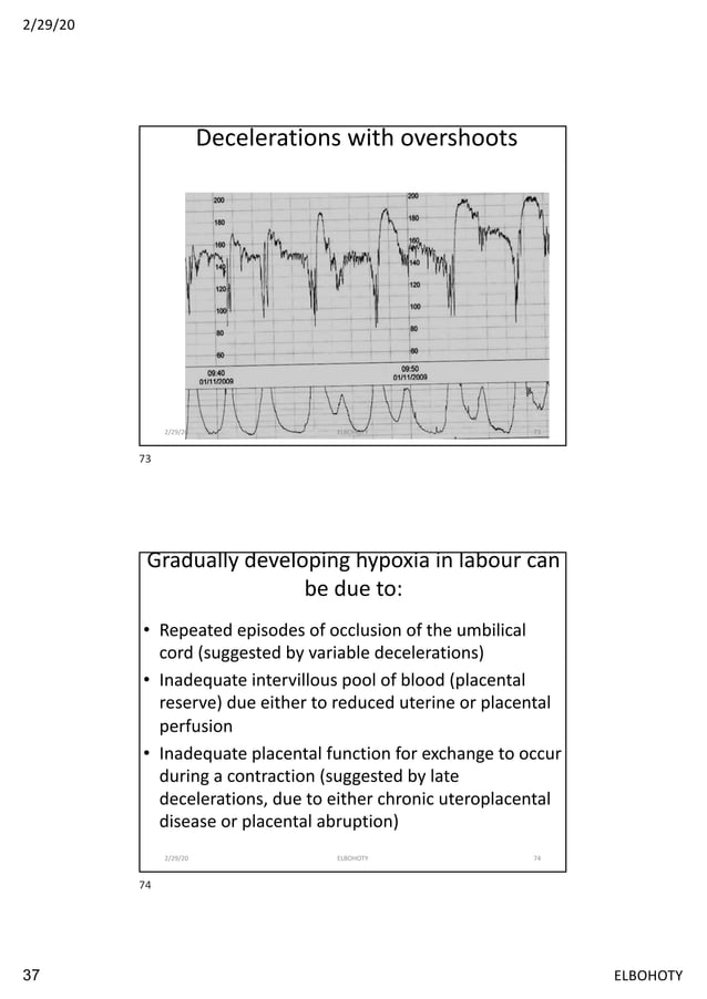 Electronic fetal monitoring | PDF