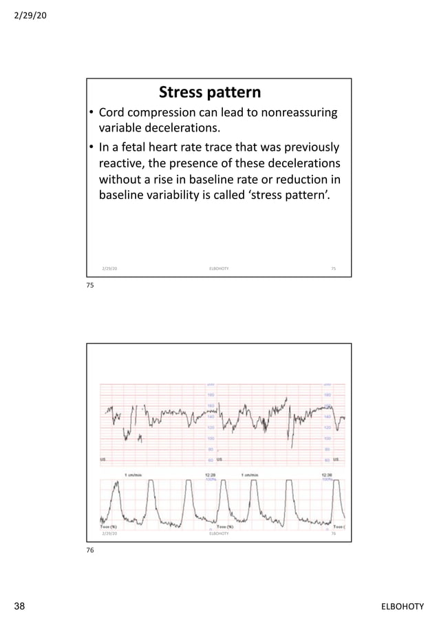 Electronic fetal monitoring | PDF