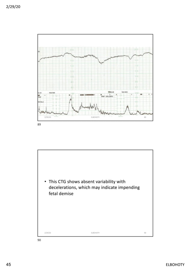 Electronic fetal monitoring | PDF
