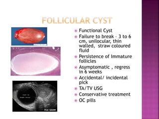 7. ovarian cysts | PPT