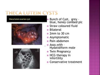 7. ovarian cysts | PPT