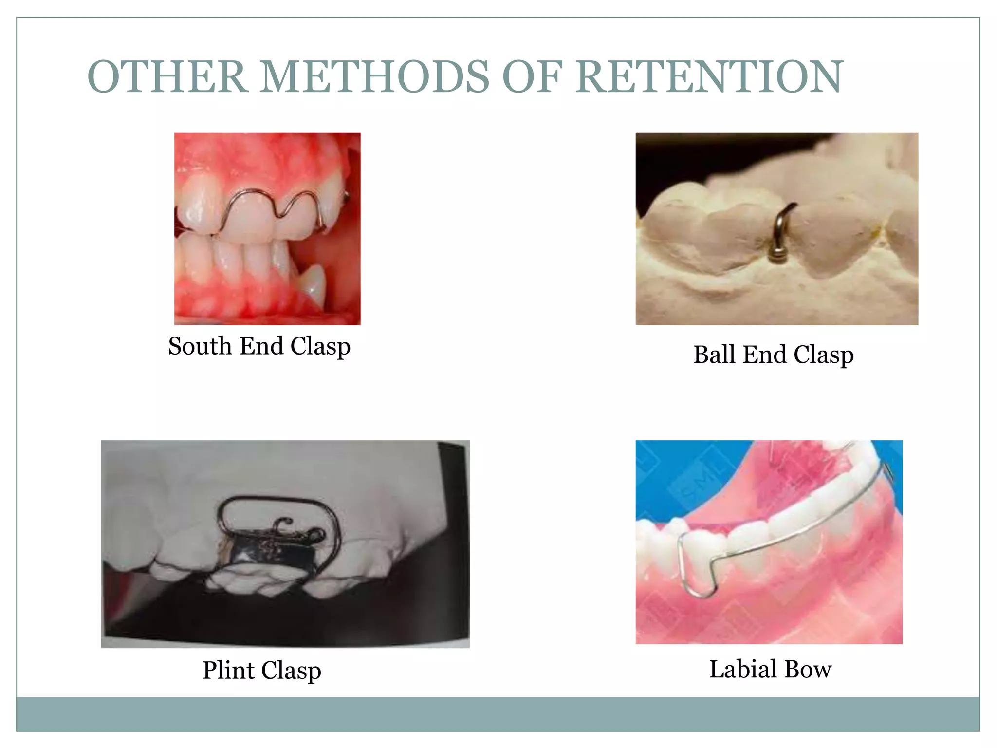 7. removable appliances | PPTX
