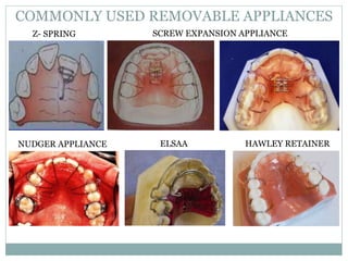 7. removable appliances | PPT