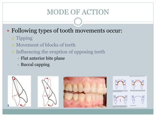 7. removable appliances | PPTX