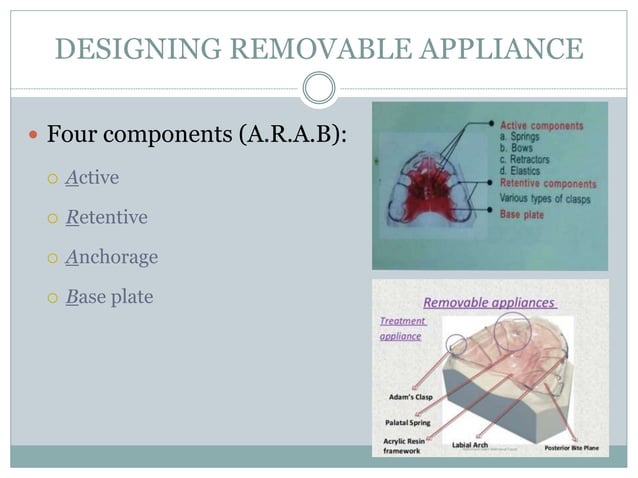 7. removable appliances | PPTX