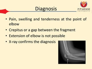 7. Dislocation of elbow and other fractures near elbow | PPT