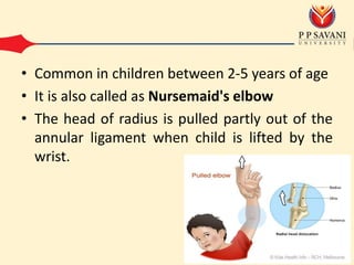 7. Dislocation of elbow and other fractures near elbow | PPTX
