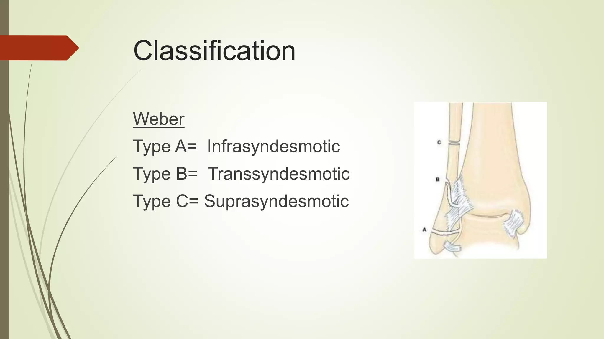 Ankle fractures | PPTX