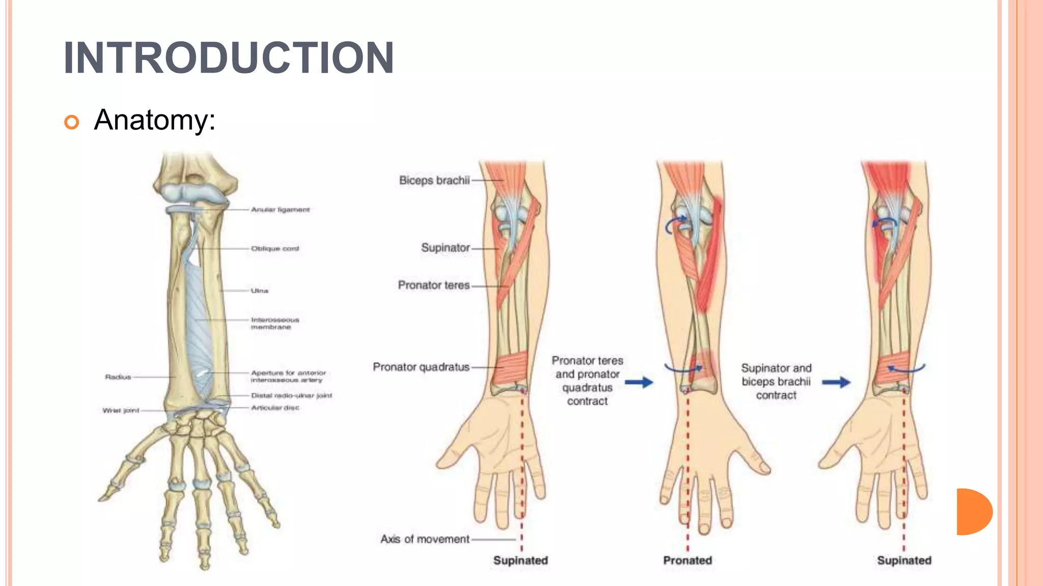 Forearm fractures | PPTX