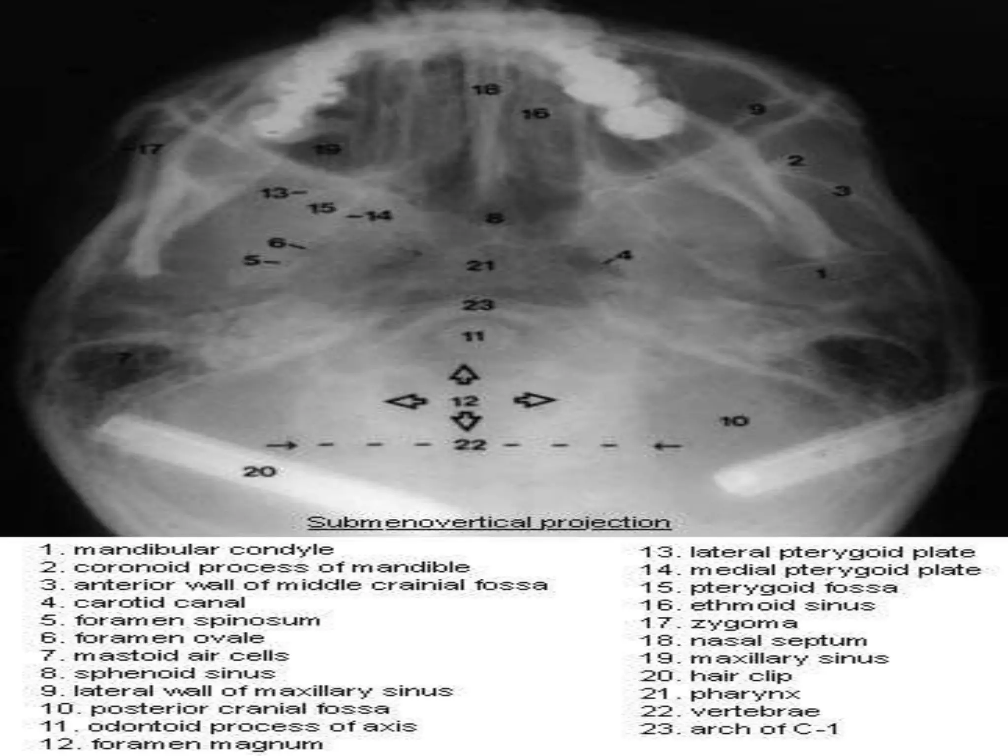 Skull positions for radiologists | PPT