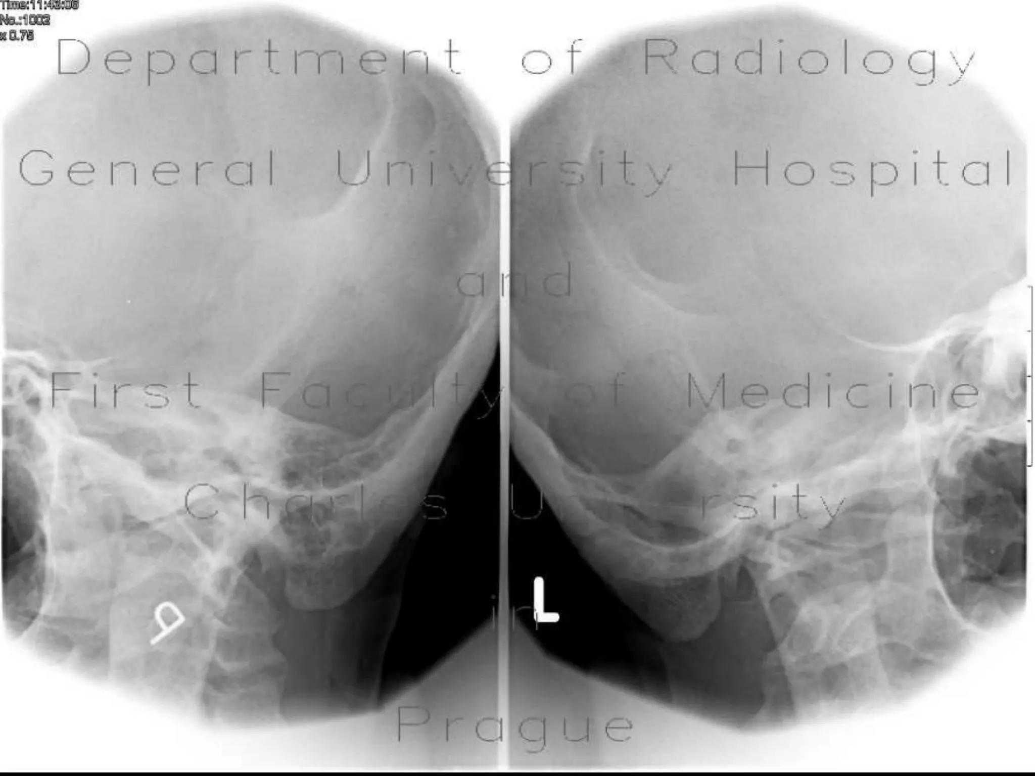 Skull positions for radiologists | PPT