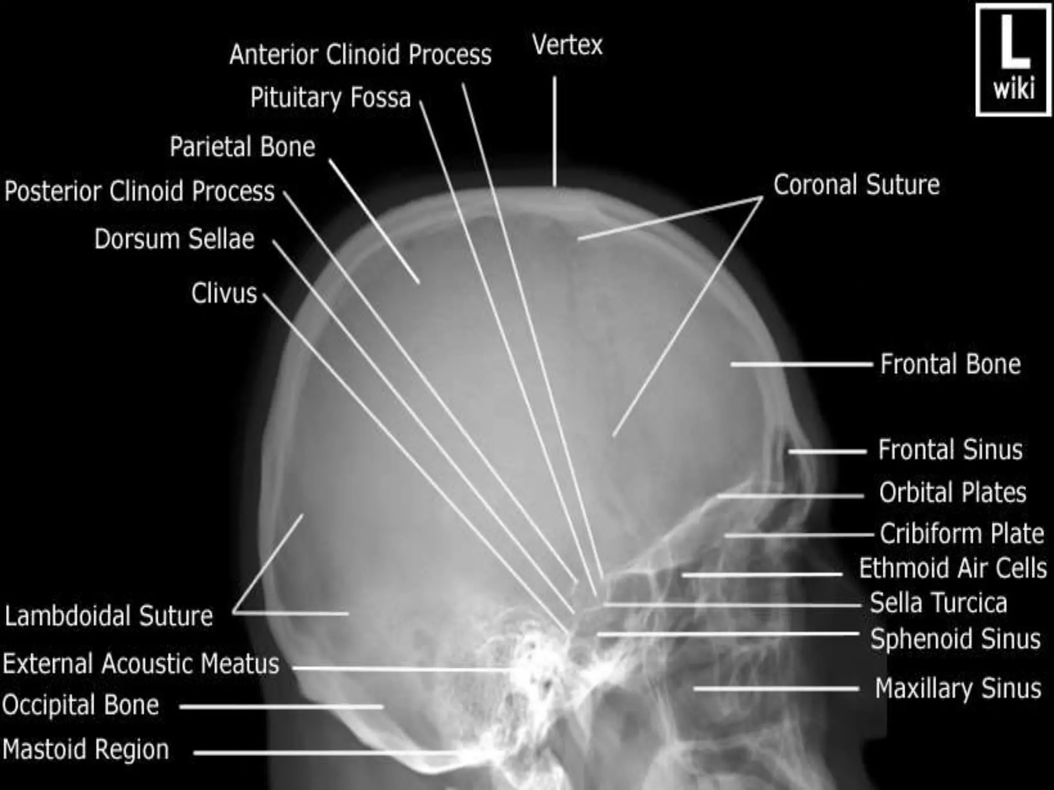 Skull positions for radiologists | PPT