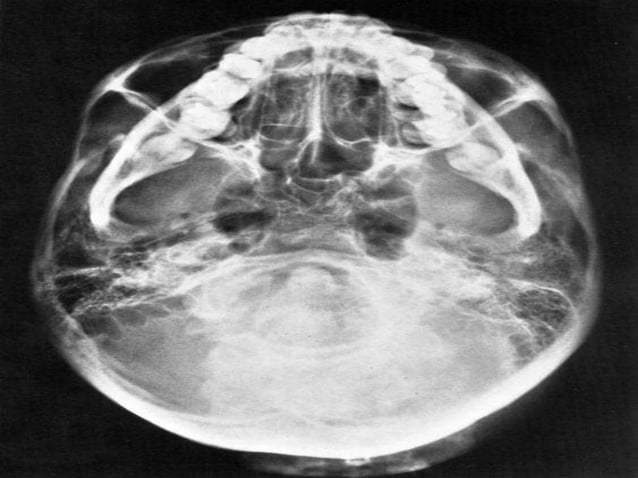 Skull positions for radiologists | PPT