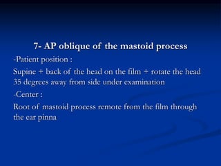 Skull positions for radiologists | PPT