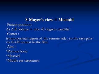 Skull positions for radiologists | PPT