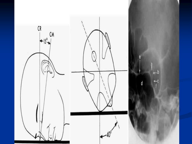 Skull positions for radiologists | PPT