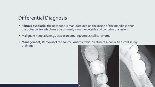 Radiographic Interpretation of Inflammatory Lesions of the Jaws | PPTX ...