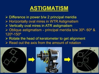 Keratometry | PPT