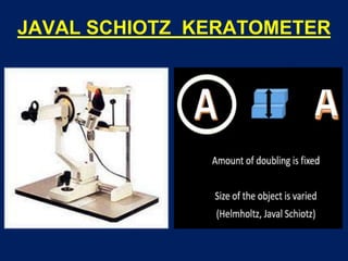 Keratometry | PPT