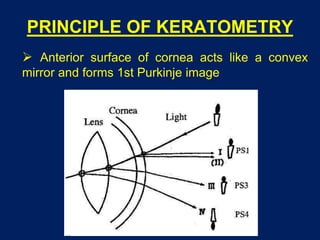 Keratometry | PPT
