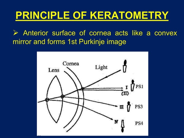 Keratometry | PPT