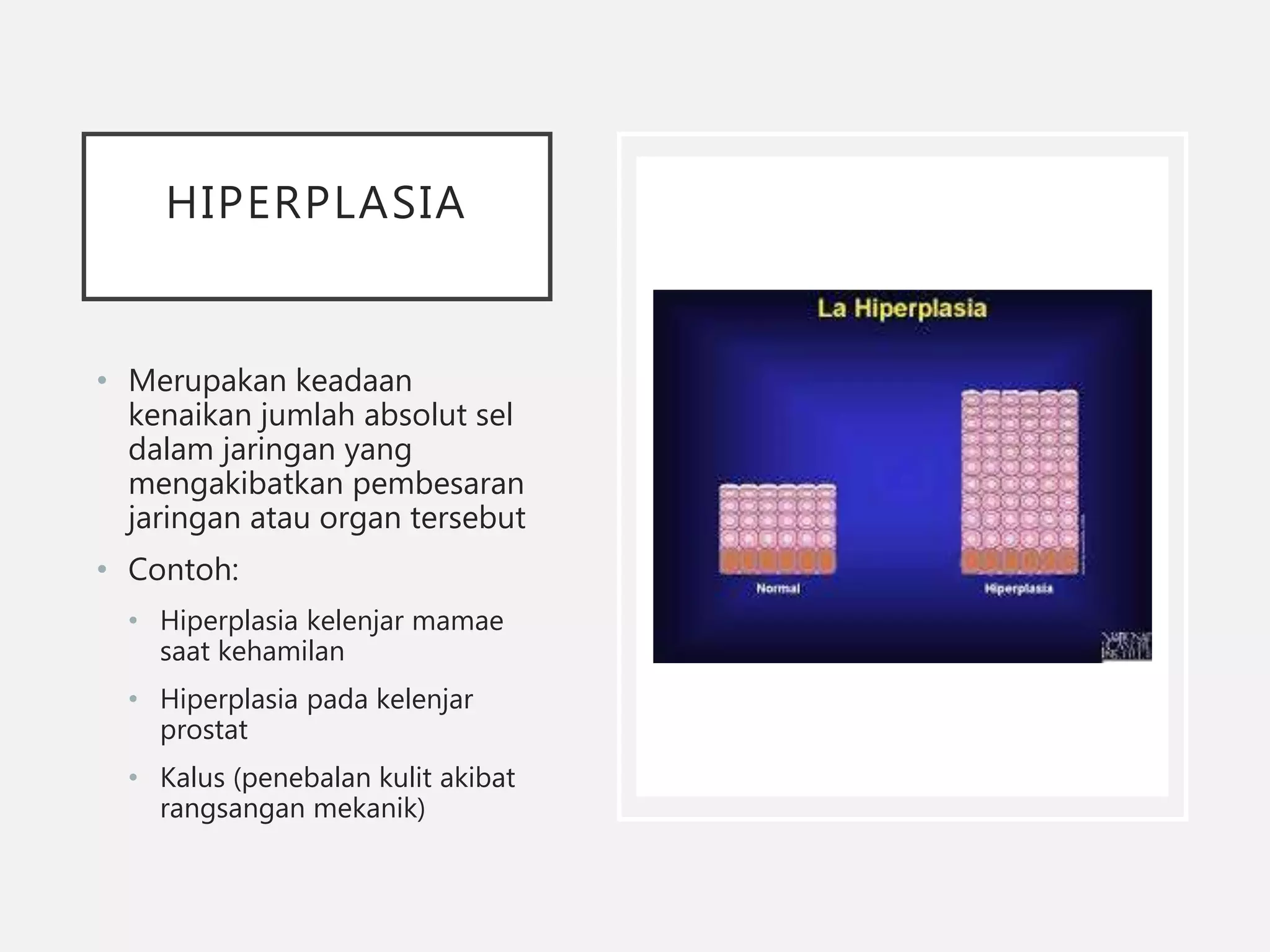7. penyakit neoplasia | PPTX