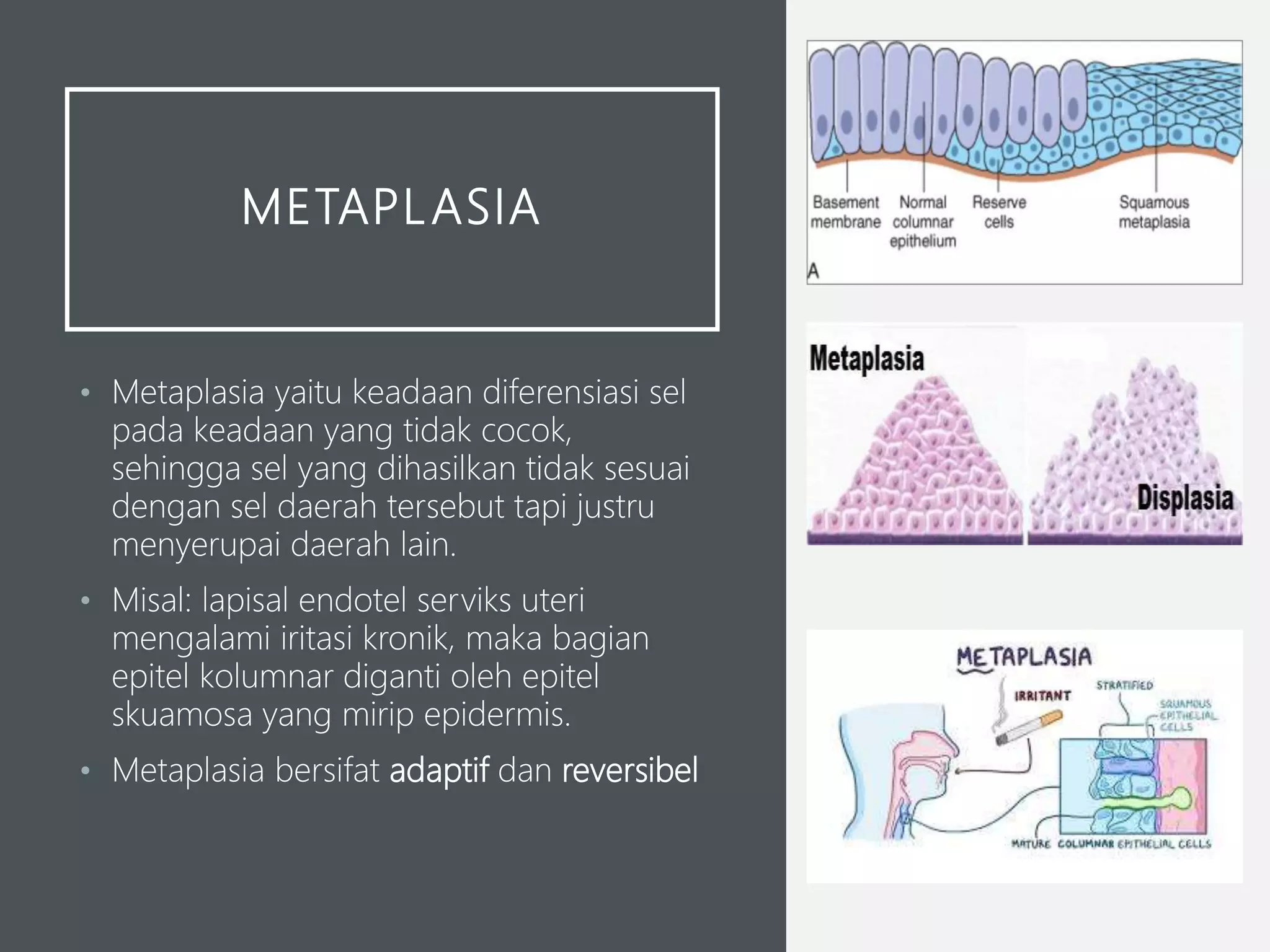 7. penyakit neoplasia | PPTX