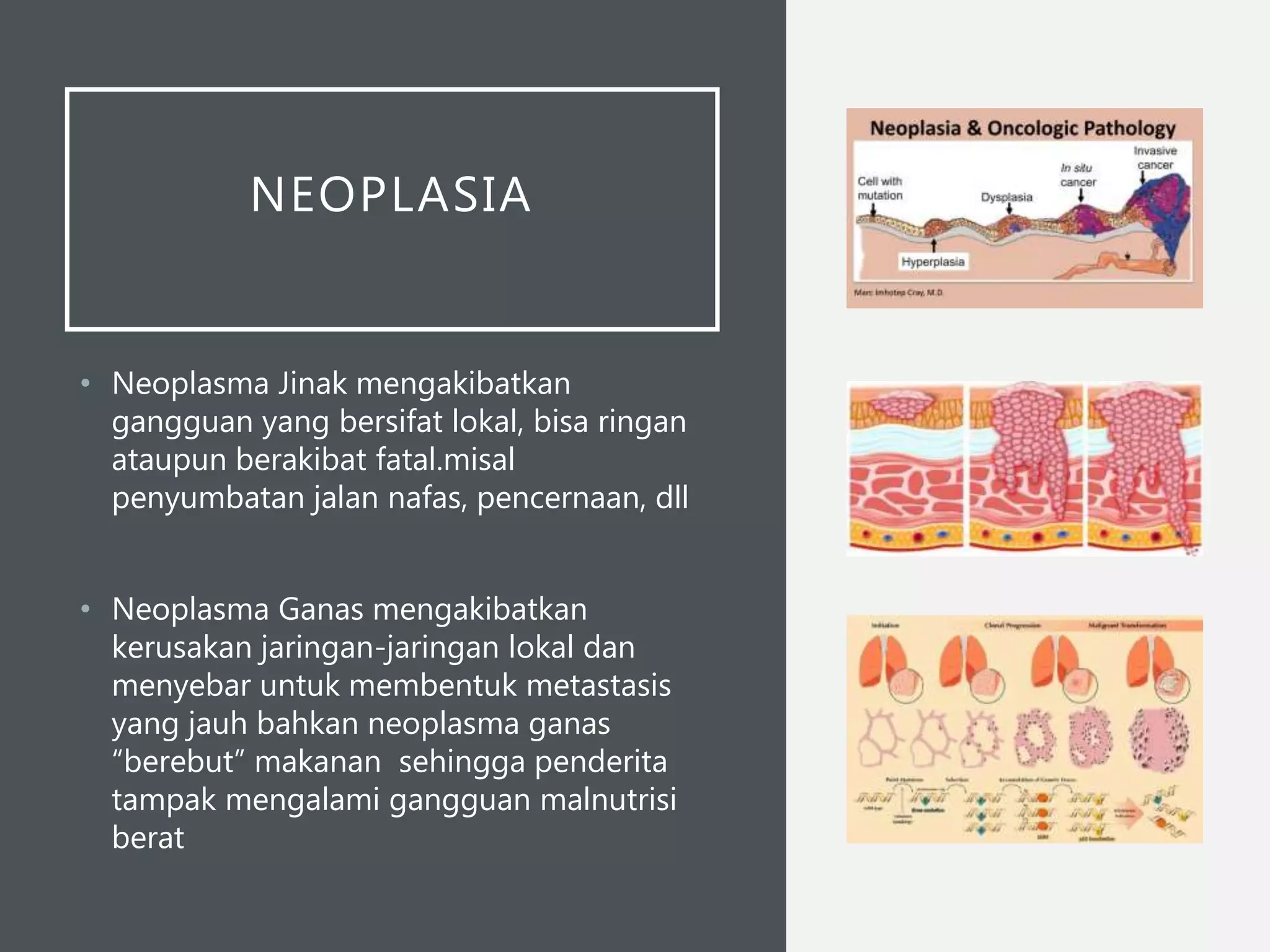 7. penyakit neoplasia | PPTX