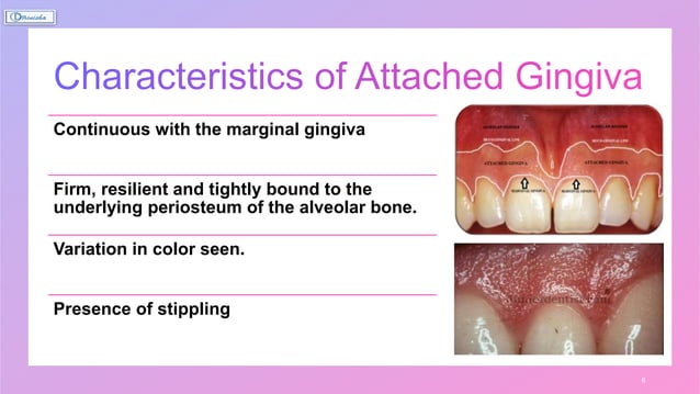 Attached Gingiva.pptx