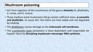 7. ACUTE LIVER FAILURE | PDF